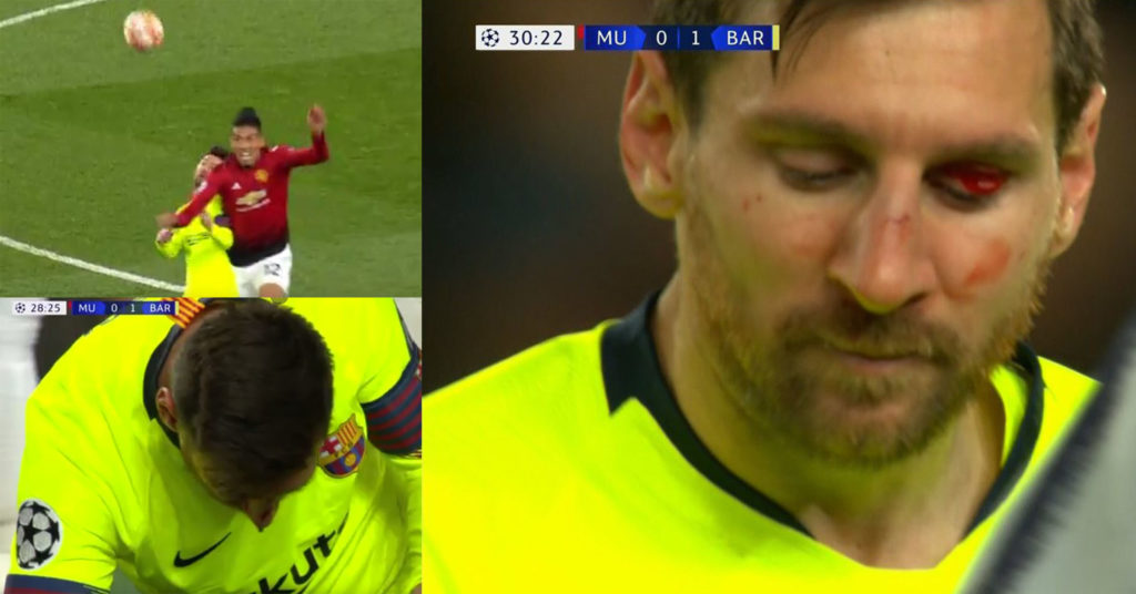 WATCH: Smalling Absolutely Smashes Messi, Leaving Messi With Blood All ...