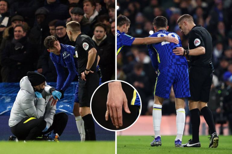 Photo: Chelsea's Kai Havertz suffers gruesome finger injury vs Tottenham